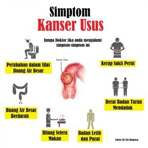 Kanser Usus : Punca, Simptom dan Rawatan - The Diagnosa